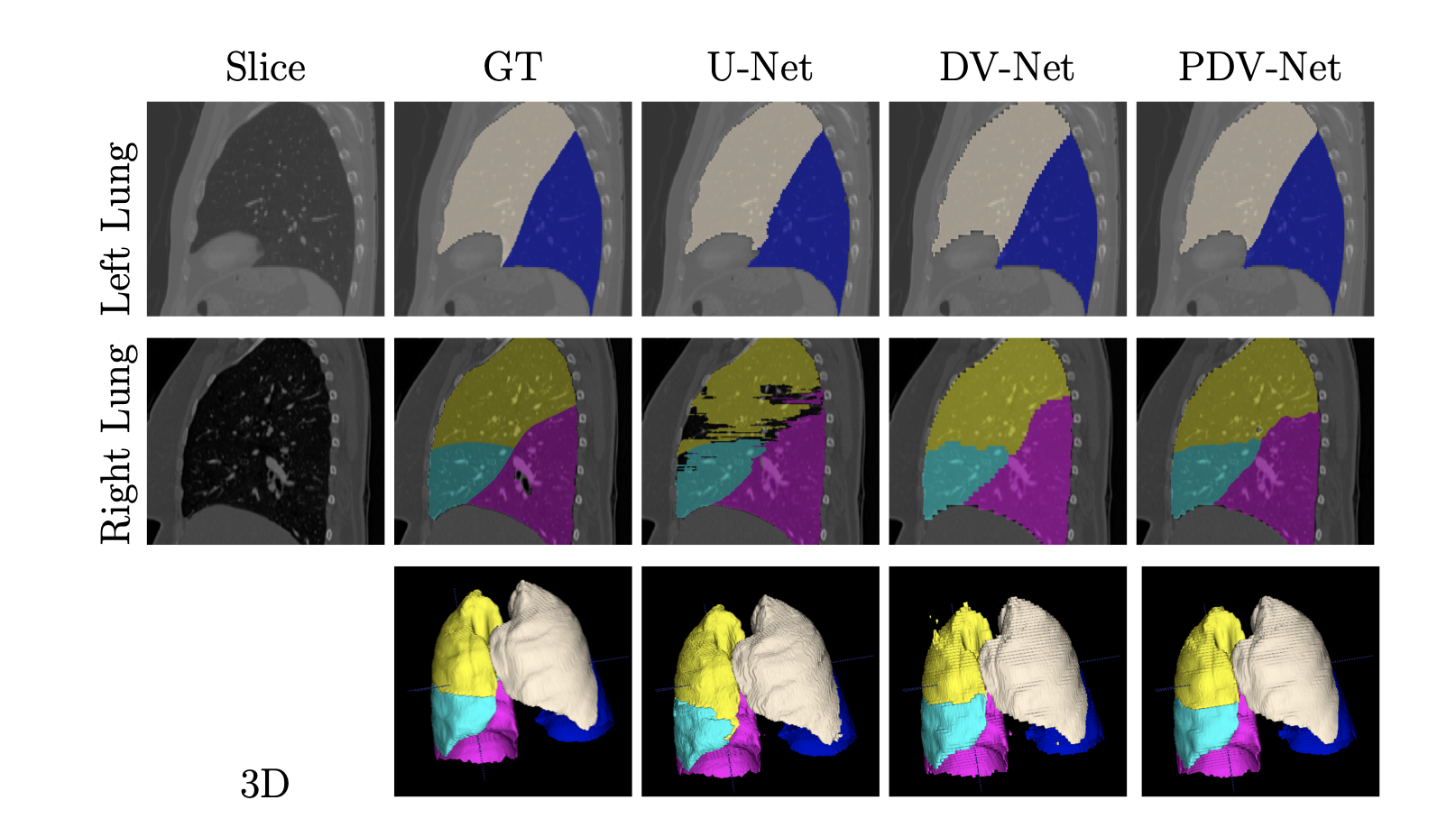 Medical Image Segmentation